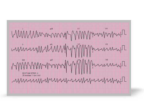 Resuscitation Council (UK) - Advanced Life Support - Completion